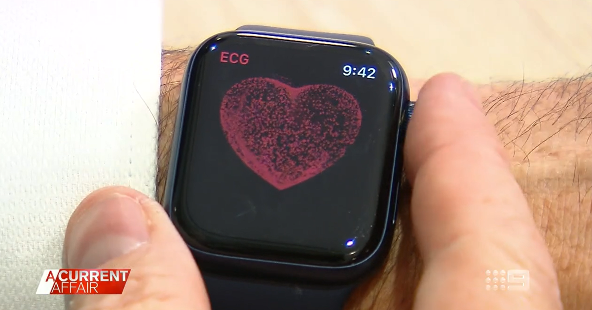 Apple Watch: Could smart watch save life from heart problems