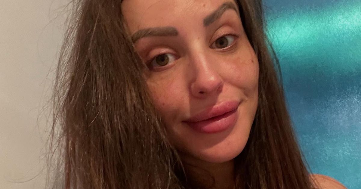 MAFS' Elizabeth Sobinoff shares warning as she experiences cold sore on ...