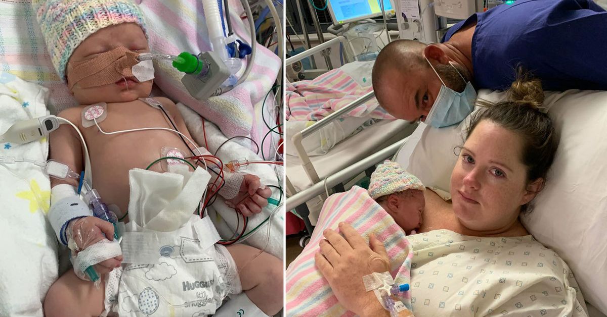 Congenital Heart Disease: 'I watched my baby have a heart attack when ...