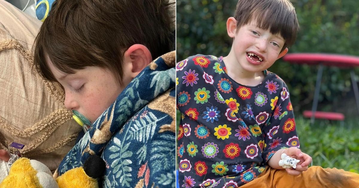 Congenital heart disease: At only seven, Charlie's already had more ...