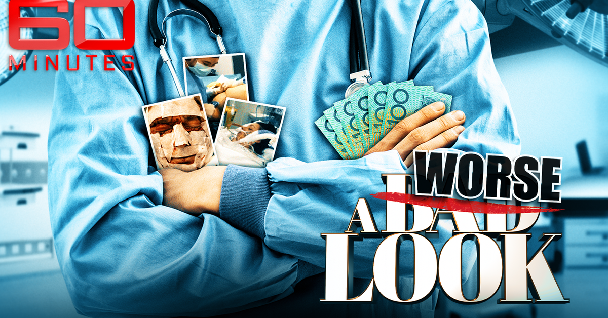 A Worse Look: Update