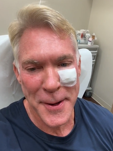 Skin cancer: Good Morning America's Sam Champion shares skin cancer ...