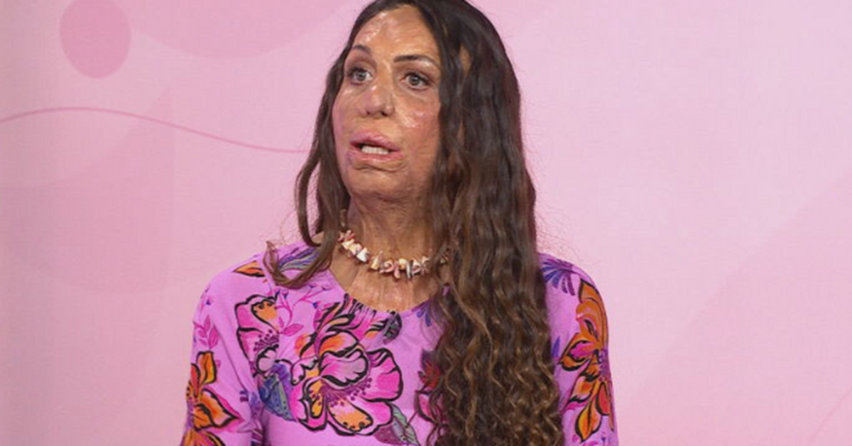 Turia Pitt shares her journey of burnout and the importance of self ...