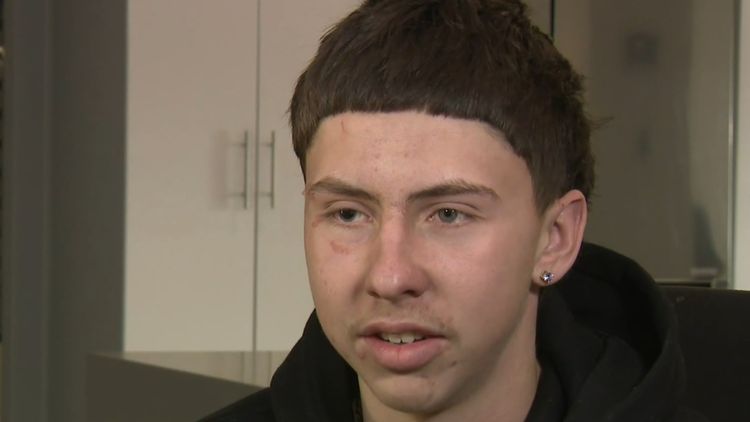 Perth news: Emergency surgery for teen after bizarre Perth glass attack
