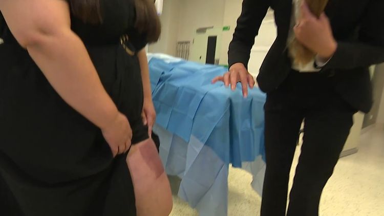 3D-printed skin used to treat burns victims in world-first breakthrough