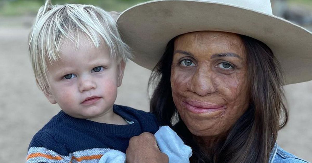 Turia Pitt exclusive: The moment Turia Pitt realised that she needed to ...