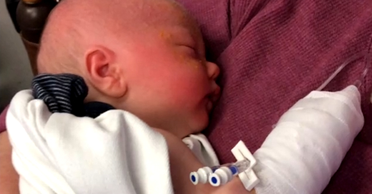 Xeroderma pigmentosum: Mild redness was the first sign baby had before ...