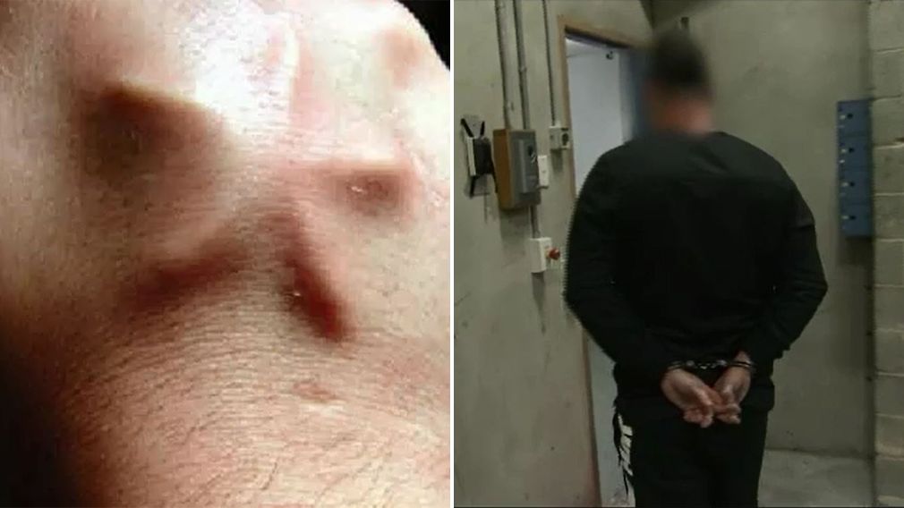 NSW body modification: Central Coast man charged with manslaughter