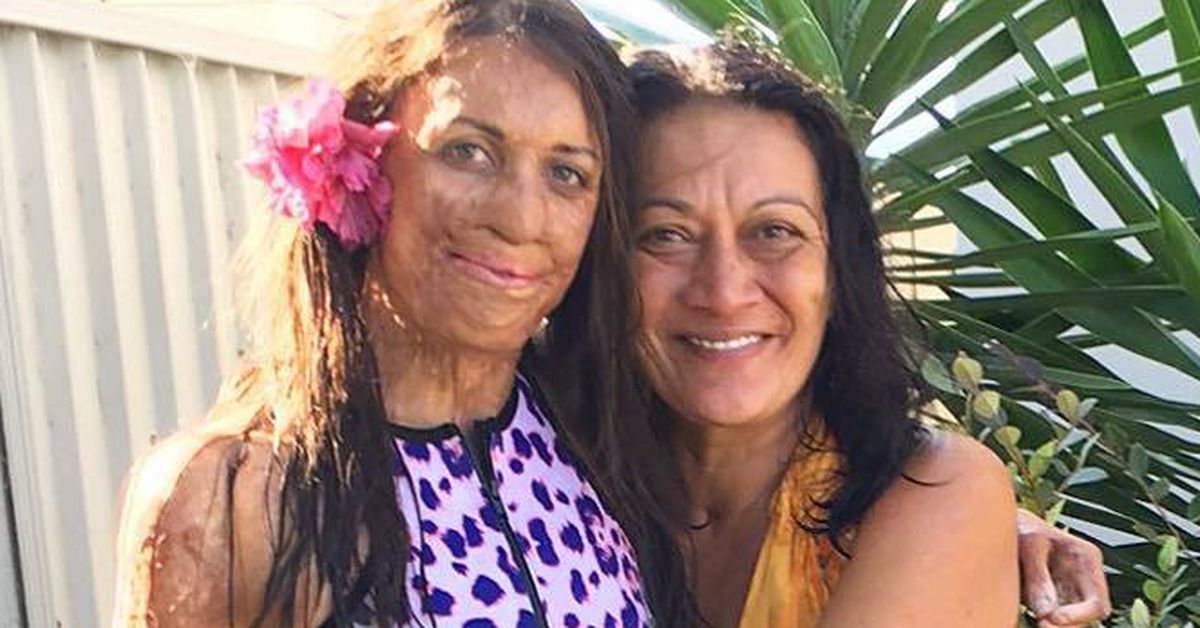 Turia Pitt: My mum is my role model and taught me the most important ...