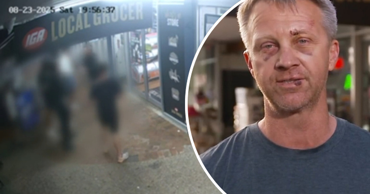 Small business owner suffers graphic injuries following alleged beating