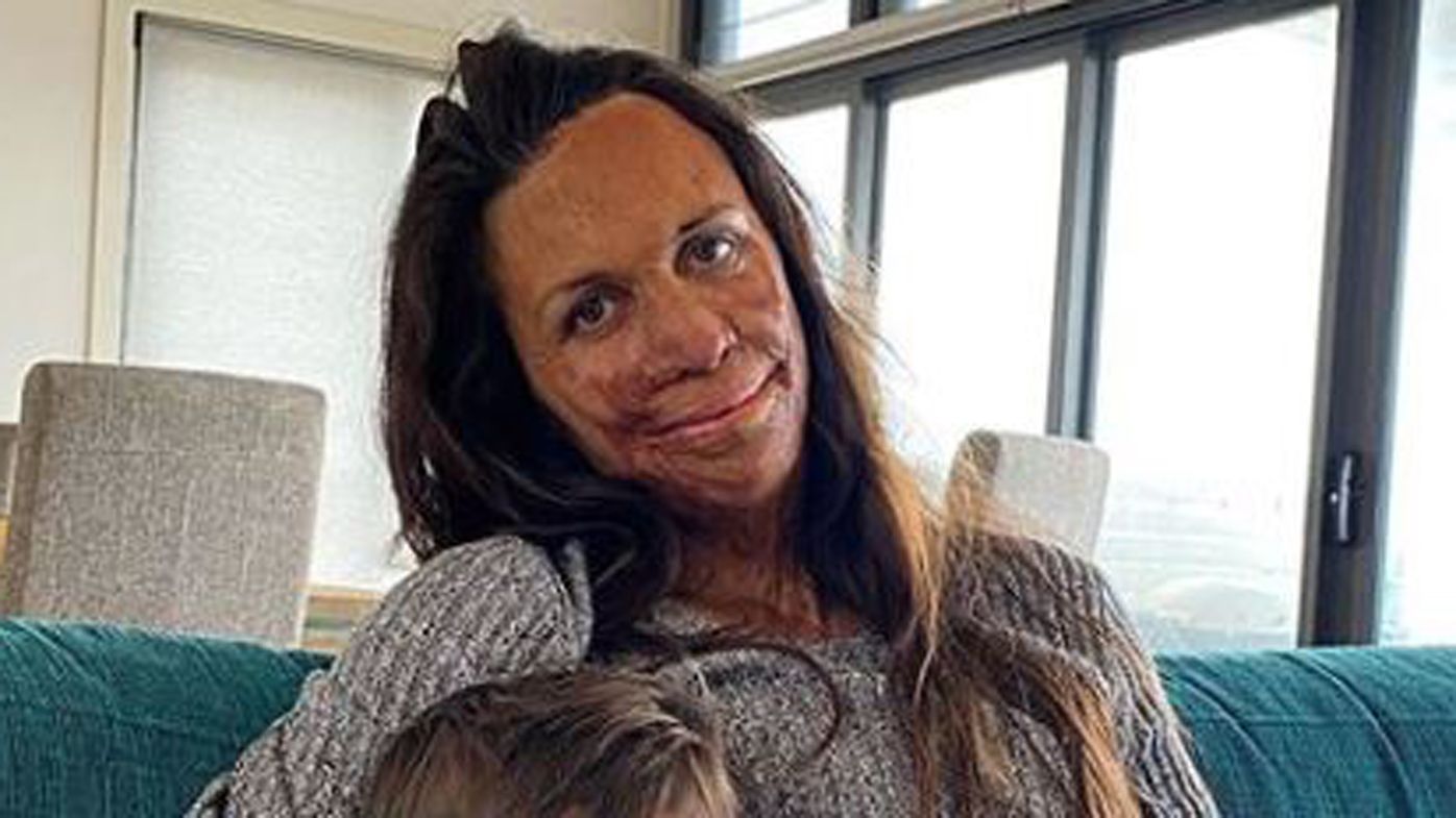 Turia Pitt's Instagram for fire-affected businesses overwhelmed by ...