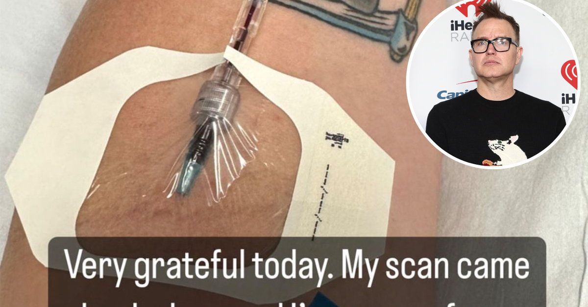 Blink-182 singer Mark Hoppus reveals positive health news - 9Celebrity