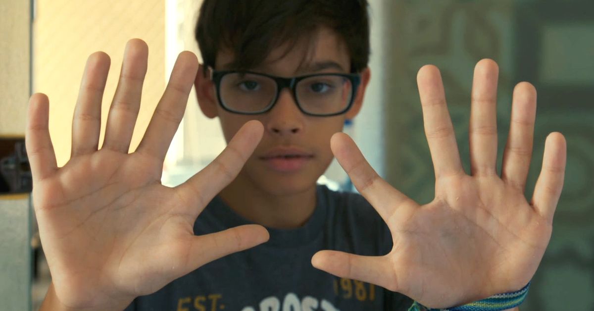 Body Bizarre: Meet the De Silva family – a 14-member clan all with six ...