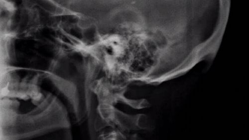 Health news Australia: ‘Young Australians’ excessive mobile phone use ...