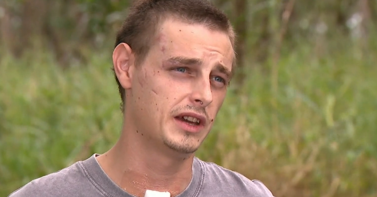 Loganlea hit run: 'Left me there to die': Young dad opens up on alleged ...