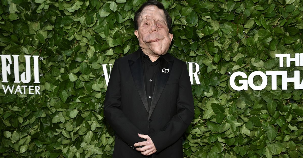 Gotham Awards 2024: Dark comedy A Different Man surprisingly triumphs ...