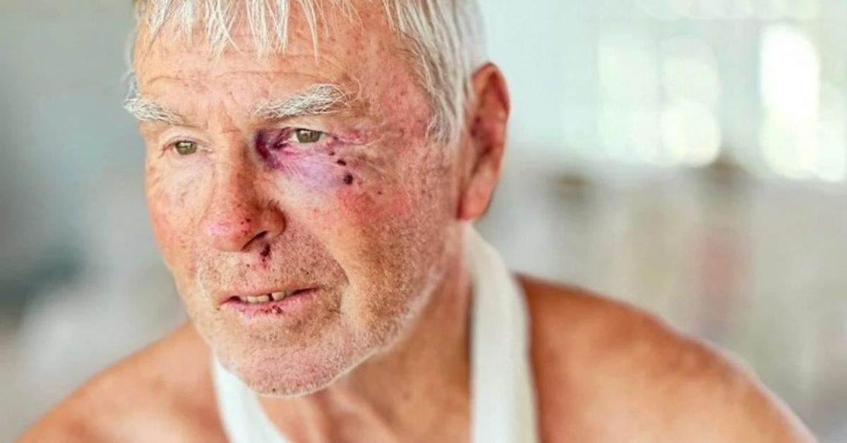 New Zealand: Man suffers life-changing injuries in horror attack by ...