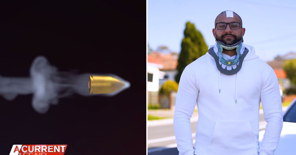 Sydney man survives a gunshot to his head after the bullet misses his ...