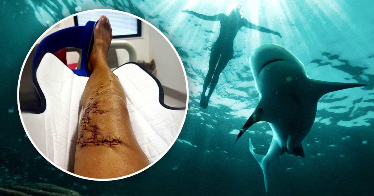 Sydney: Shark attack victim saved by strangers on secluded beach