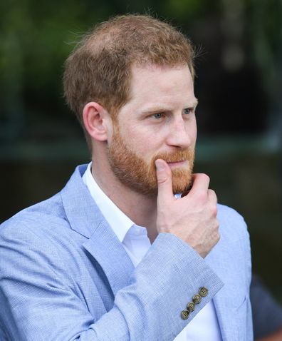 Prince Harry's bald patch has doubled since marrying Meghan Markle and ...