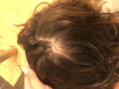 'Finally, I felt understood, like I wasn't alone, that it wasn't just ...