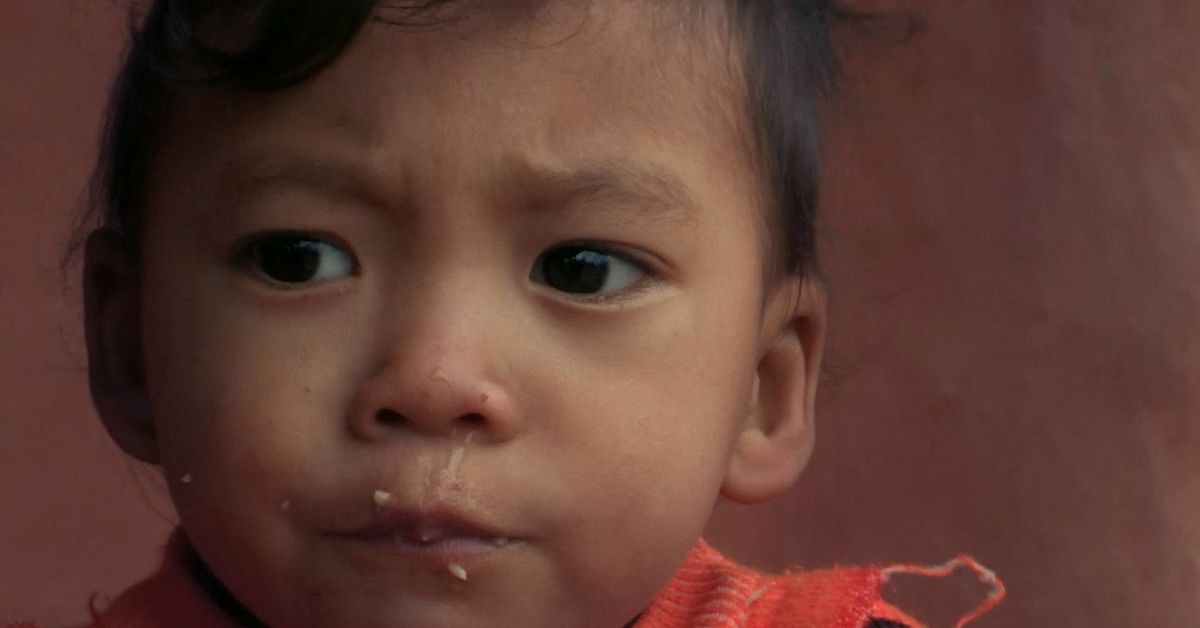 Body Bizarre: Meet the two-year-old boy born with a third arm growing ...