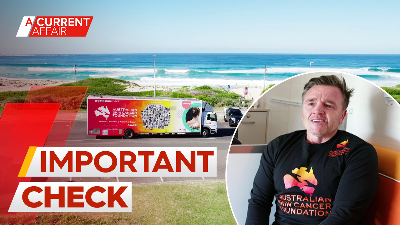 Skin check truck school visit saves young teen from deadly disease: A ...