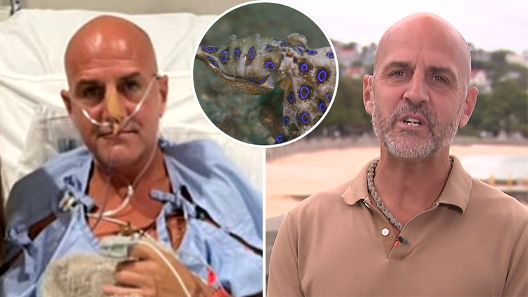 Sydney man survives blue-ringed octopus bite after hospital ordeal