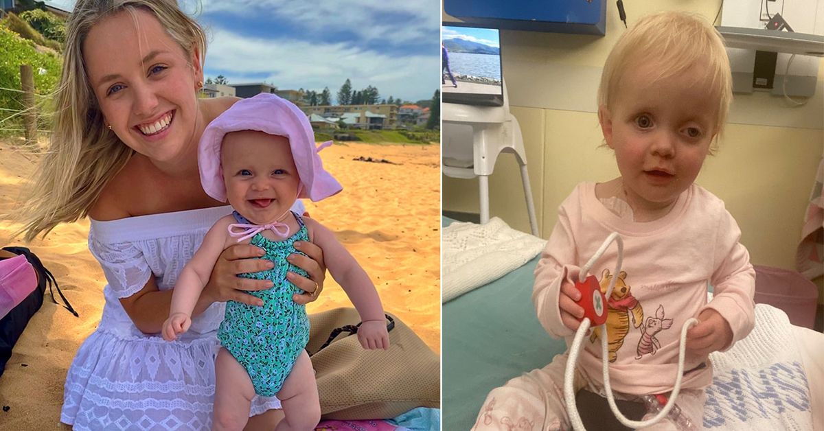 Germ cell tumour: Baby Sophia's swollen left eye was the first sign of ...