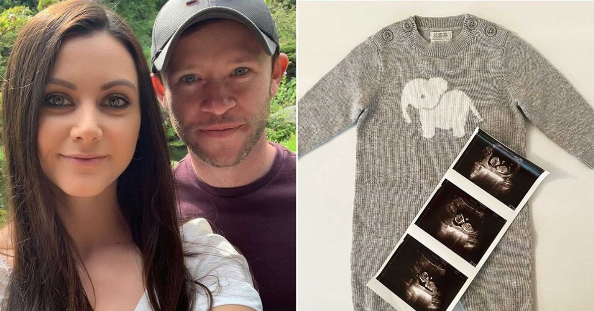 Harry Potter star Devon Murray expecting first child with Shannon ...