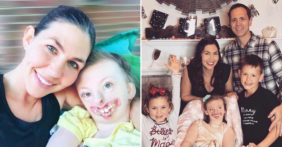 Little girl with facial deformities said heartbreaking words to mum ...